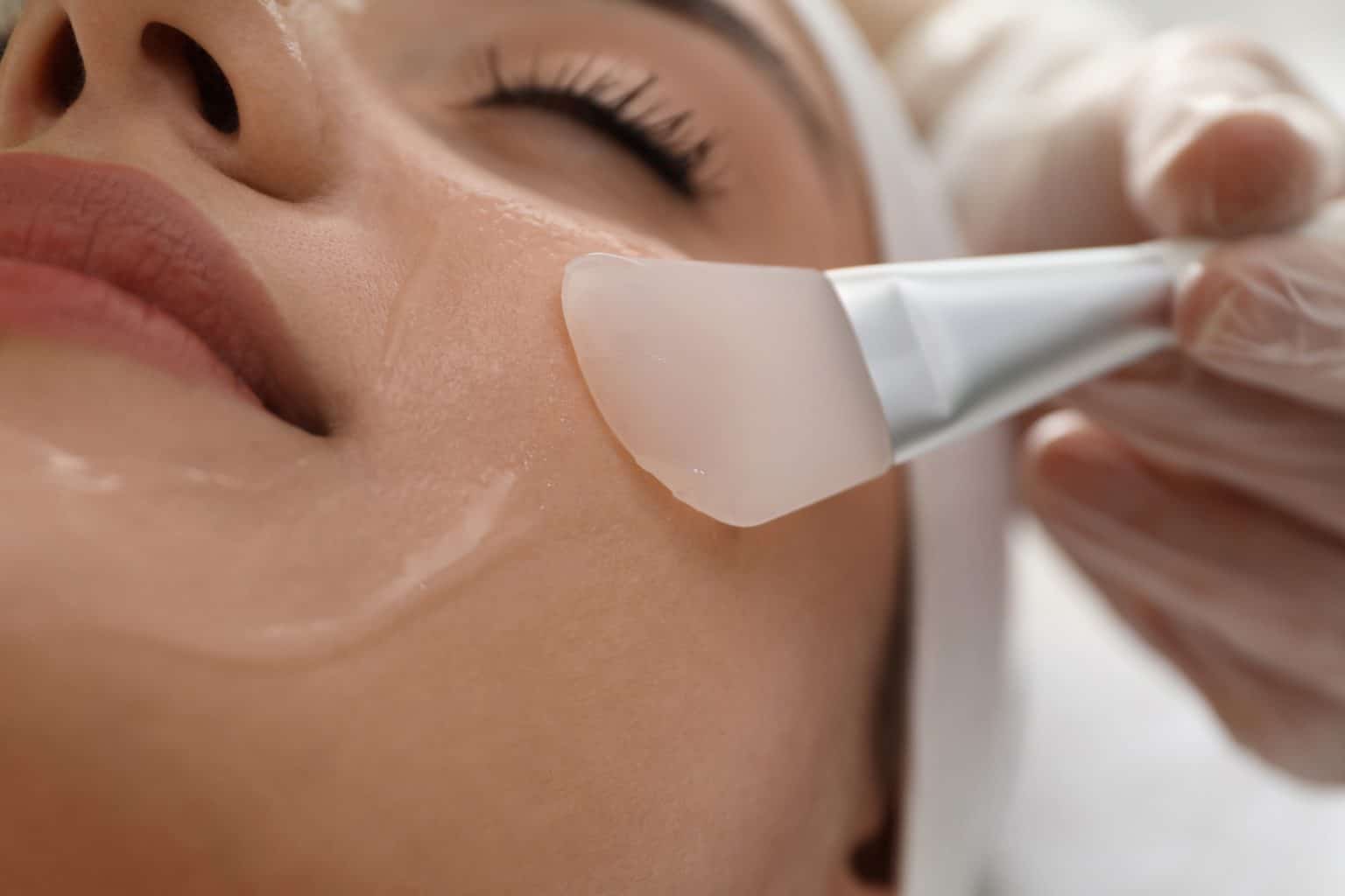 The 8 Best Chemical Peels | Blog Post Archives | Medical SpaRX