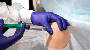 Euflexxa Dosage - Managing the Right Schedule - Medical SPA RX