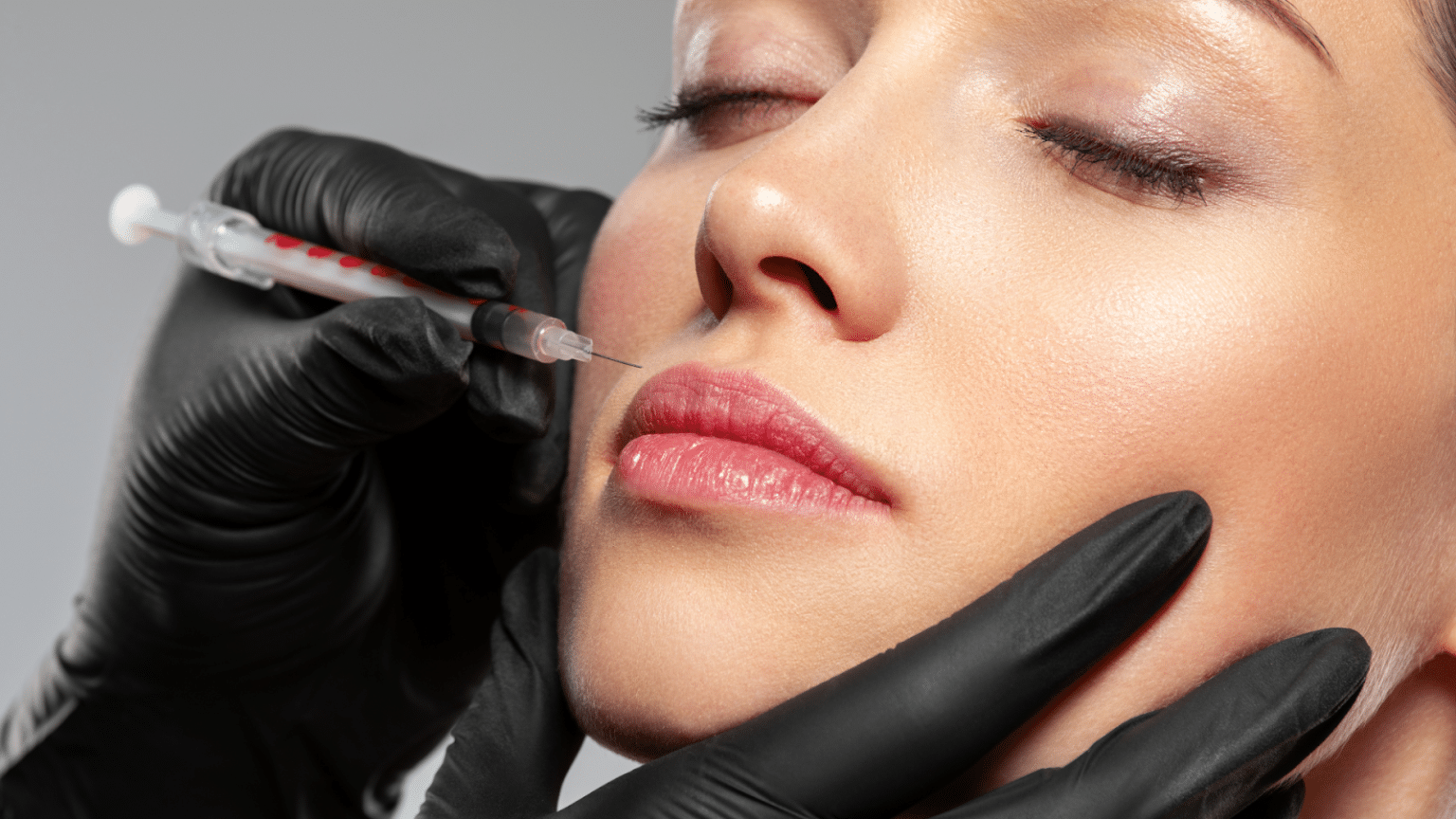 Nucleofill Before and After with Photo Examples - Medical SPA RX